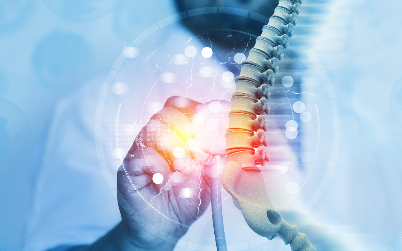 Interventional Spine Medicine, What Is It? - NewSouth NeuroSpine